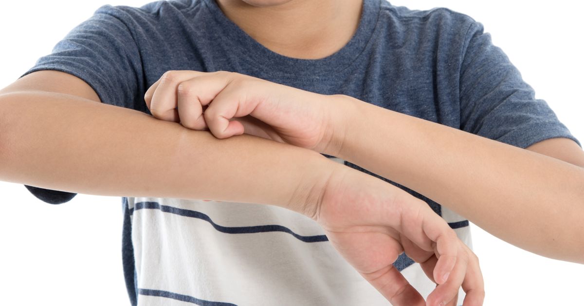 Slik behandler du atopisk eksem - Helse Stavanger HF